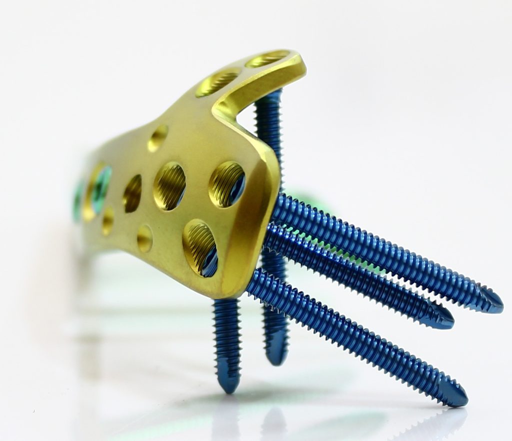 Locking Plates | SiS medical Co., Ltd.