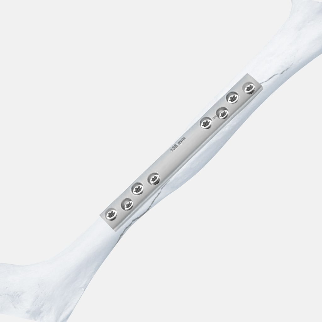 Standard Trauma | SiS medical Co., Ltd.